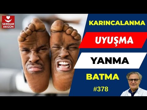 378. Ayaklarda Karıncalanma, İğne batması, Uyuşma, Üşüme, Yanma neden olur? Serdar Akgün,