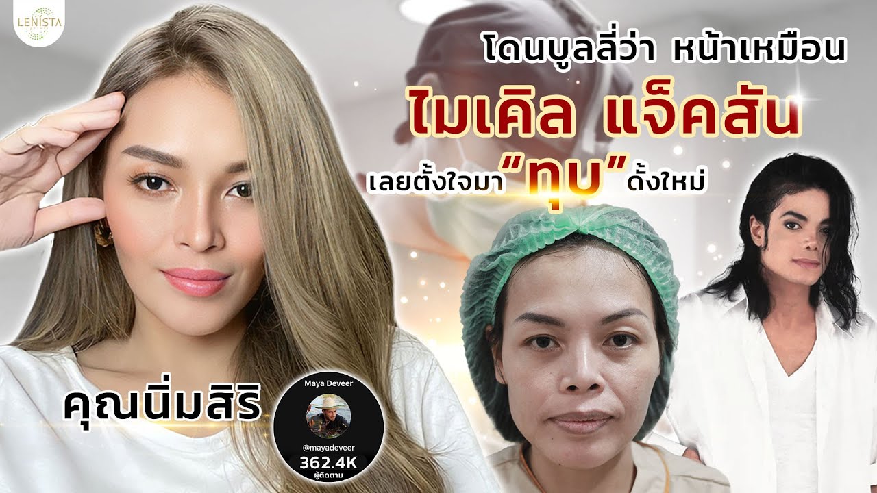 ถูกบูลลี่เรื่อง "หน้าตา" มาทั้งชีวิต ตัดสินใจ แก้จมูก #ไร้ซิลิโคน พลิก ...