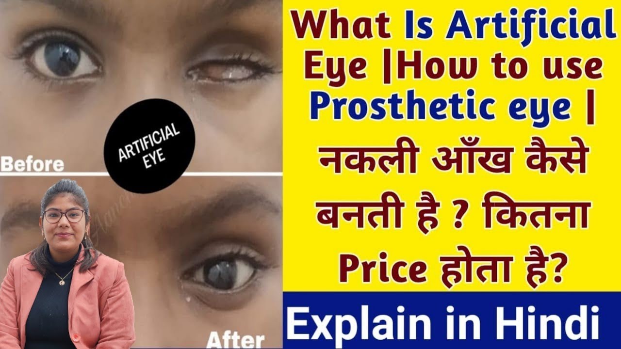 What Is Artificial Eyes Hindi How To Use Prosthetic Eye Cost what-is-artificial-eyes-hindi-how-to-use-prosthetic-eye-cost