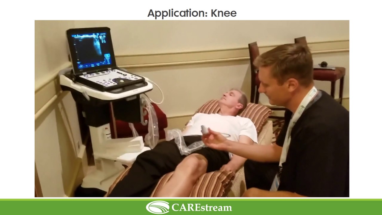 Michael Meng, D.C. using Whale Sigma P5 Ultrasound for MSK applications ...