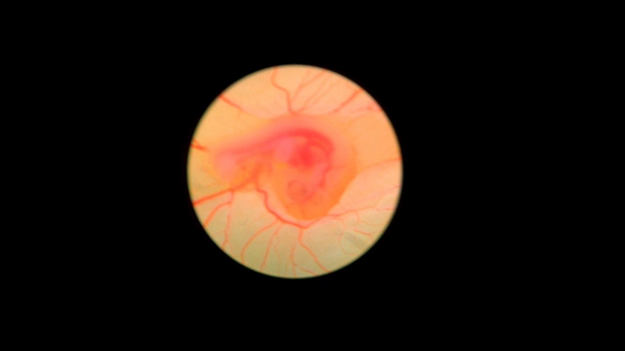 Chick embryo heart beat - YouTube