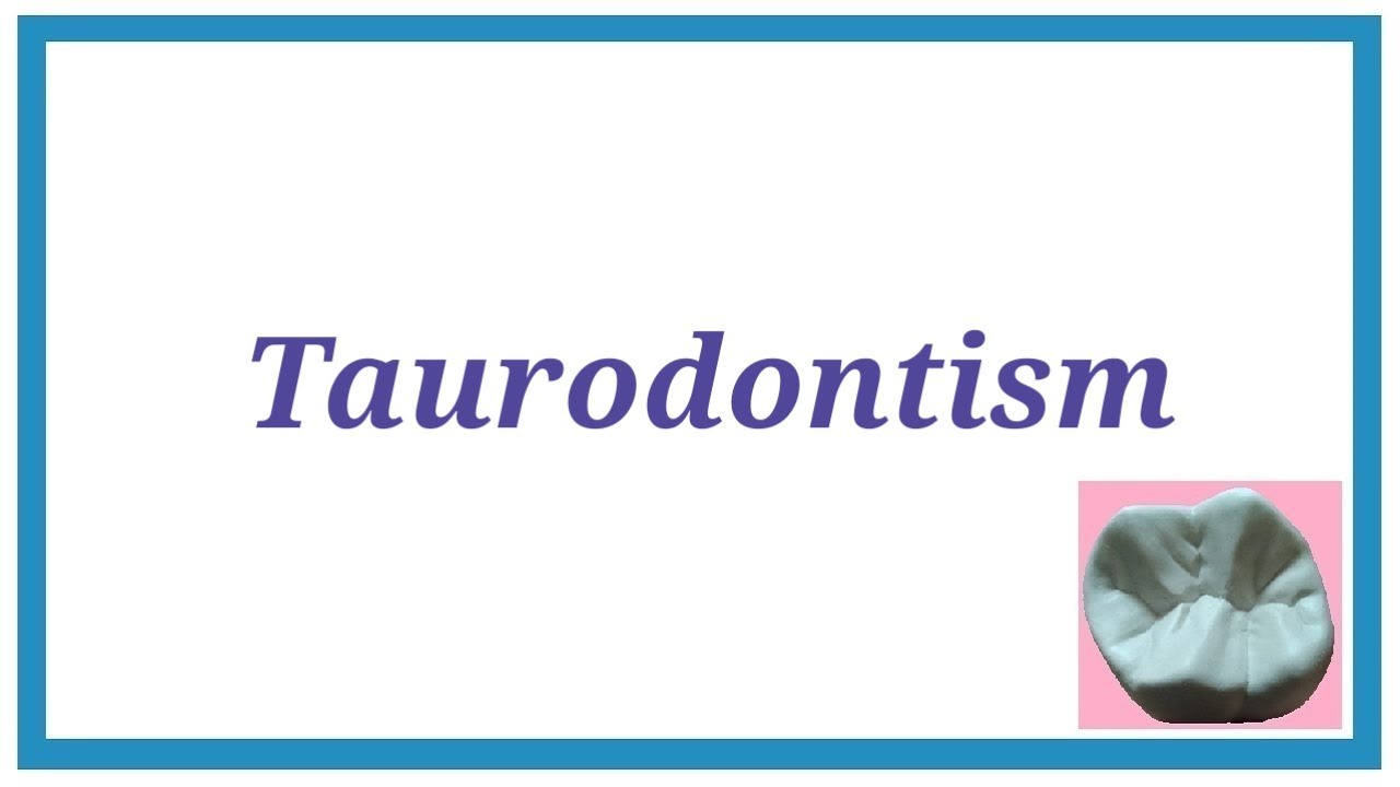 Taurodontism - Important Notes | Developmental disturbances in the ...