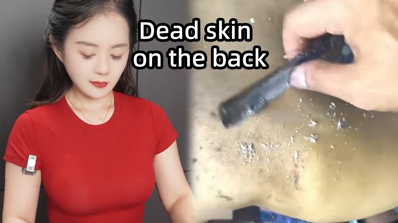 💈ASMR | Remove a lot of dead skin from a man's back. 🪒 Skillful face ...