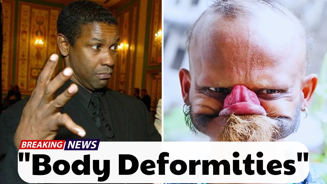 9 Celebrities With Weird Body Deformities - YouTube