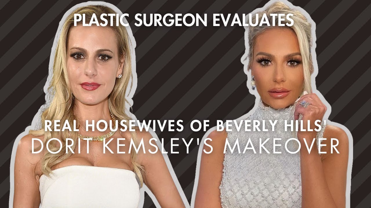RHOBH Dorit Kemsley's Makeover: Nose Job? Fillers? Just Makeup? - YouTube