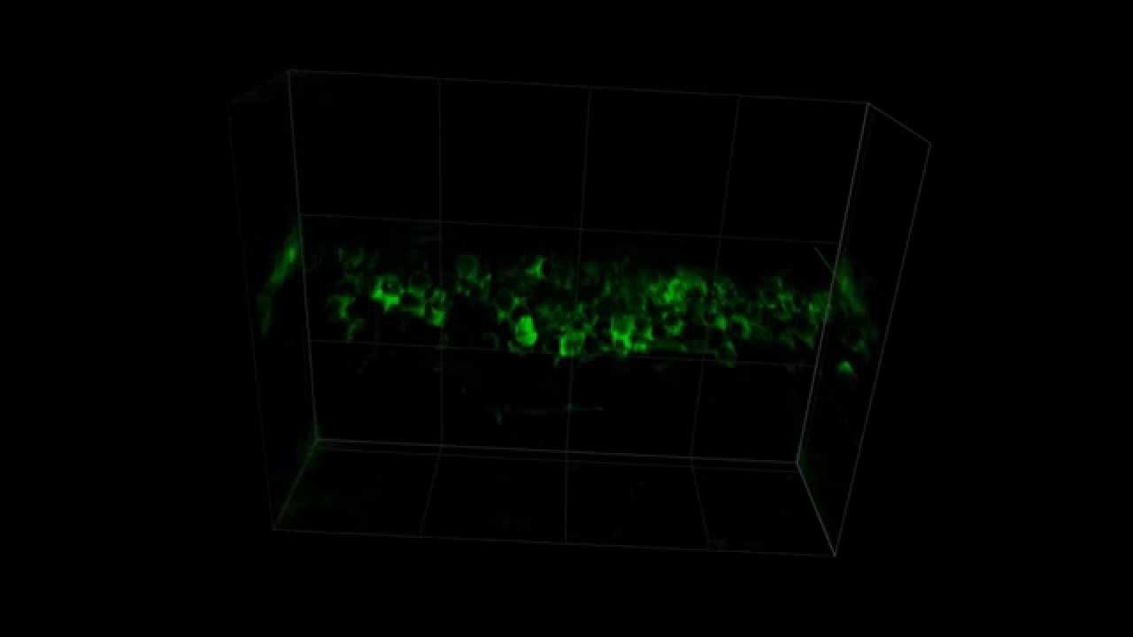 Fast Calcium Imaging with Optical Sectioning via HiLo Microscopy - YouTube
