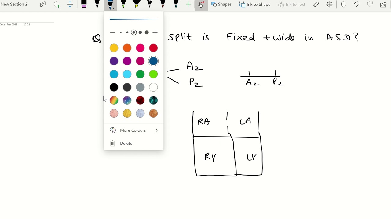 ASD S2 split is wide and fixed - YouTube