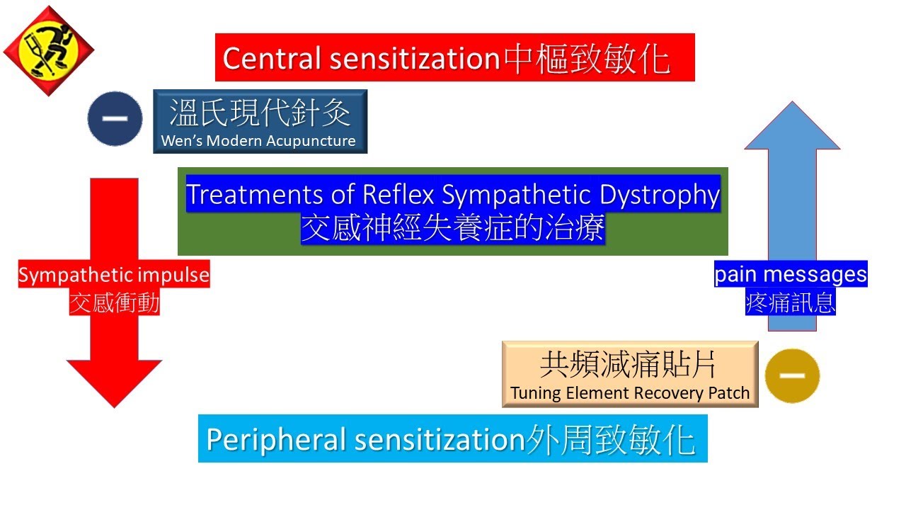 Treatments of Reflex Sympathetic Dystrophy ( hand ), 交感神經失養症的治療(手 ...