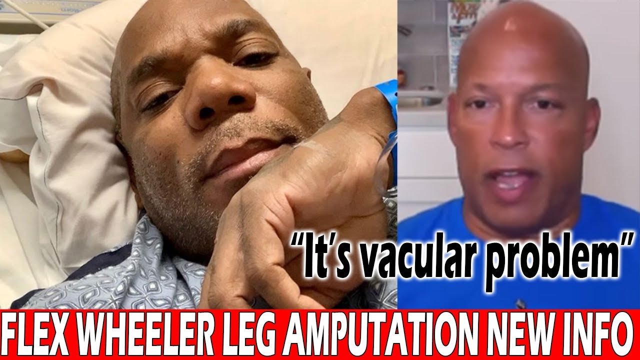 Flex Wheeler Today