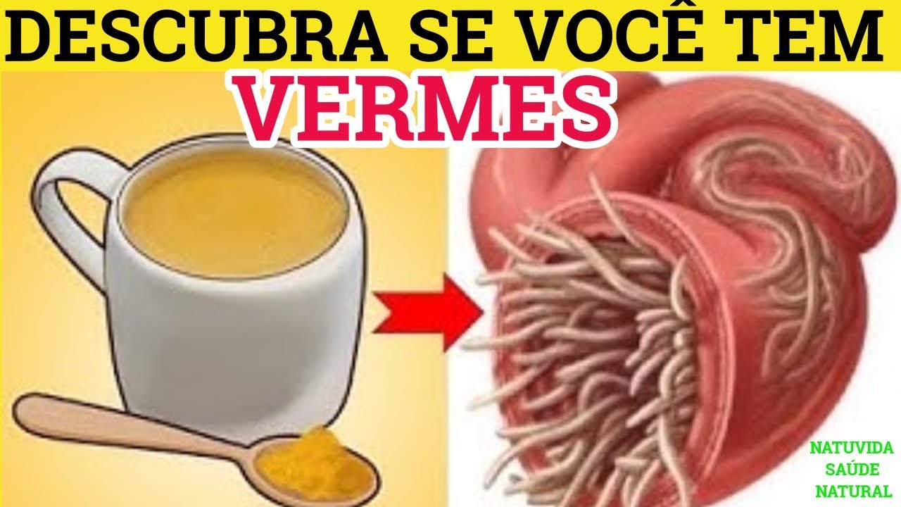 Como Matei meus PARASITAS INTESTINAIS. Vermes dentro de mim! - YouTube