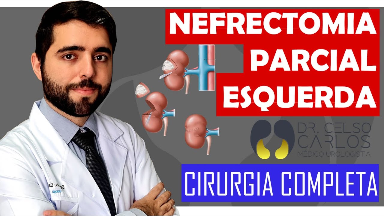 Left Partial Nephrectomy - FULL SURGERY - Laparoscopic - Brasil - YouTube