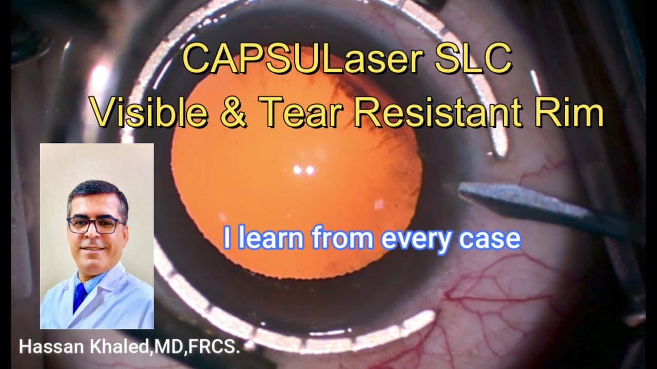 CAPSULaser SLC Visible & Tear Resistant Rim - YouTube