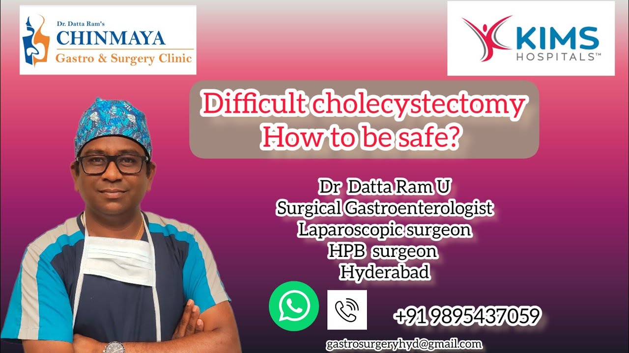 Difficult cholecystectomy, how to be safe and avoid a bile duct injury ...