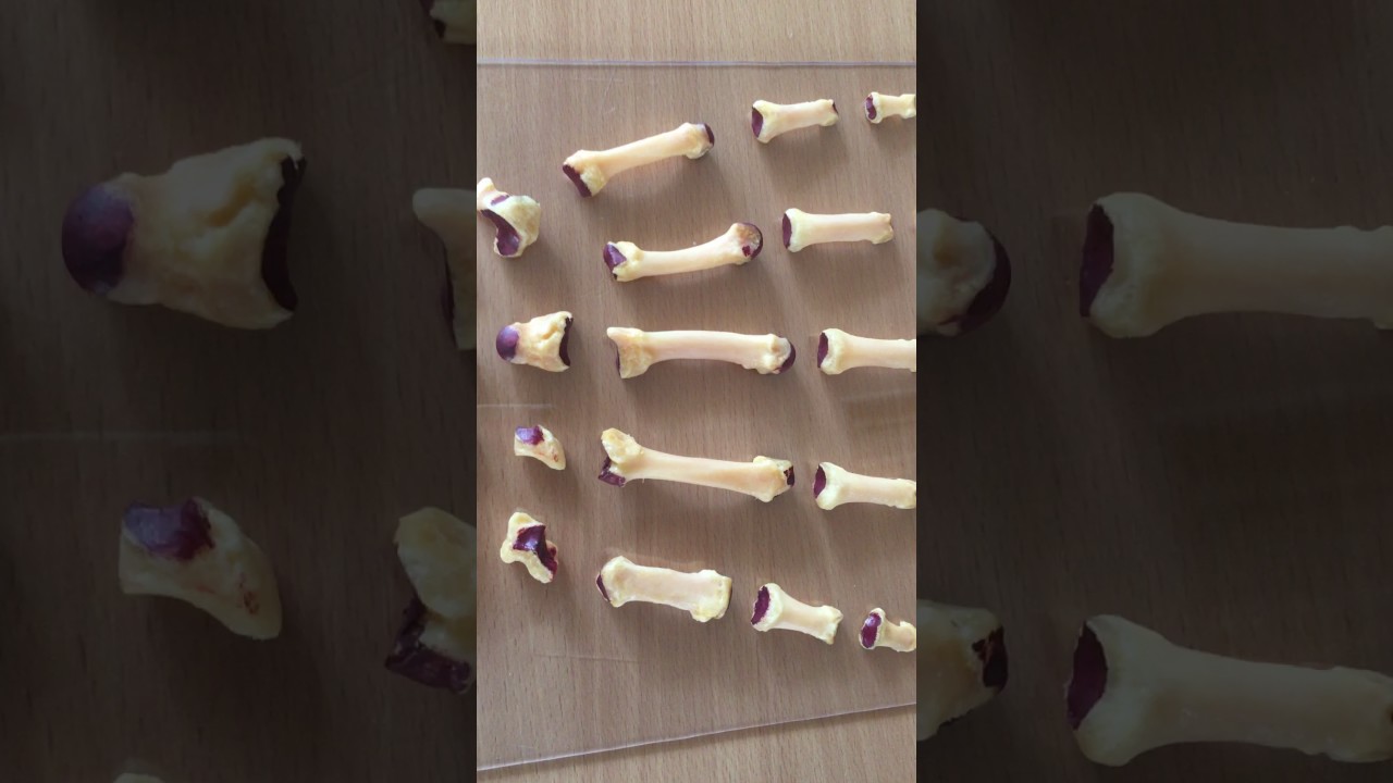 Tretia záprstná kosť (Os metacarpi tertium) - YouTube