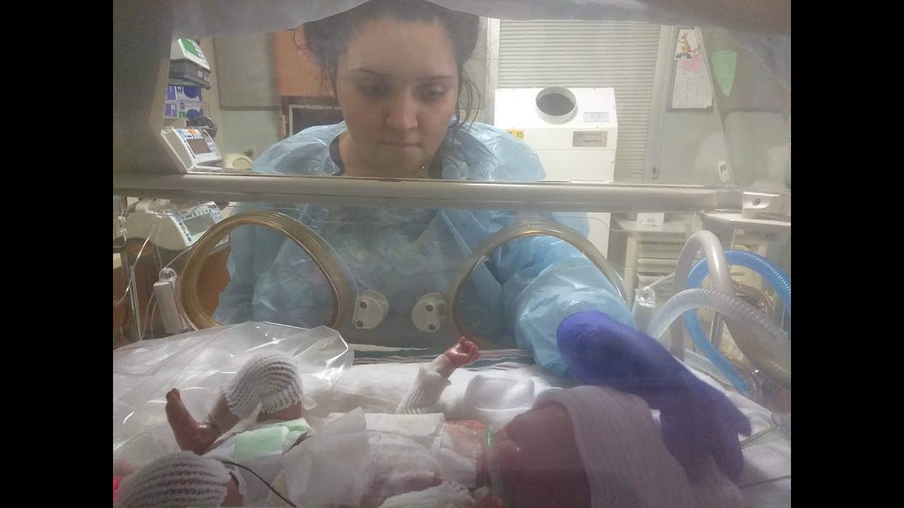 Born Without Skin - YouTube