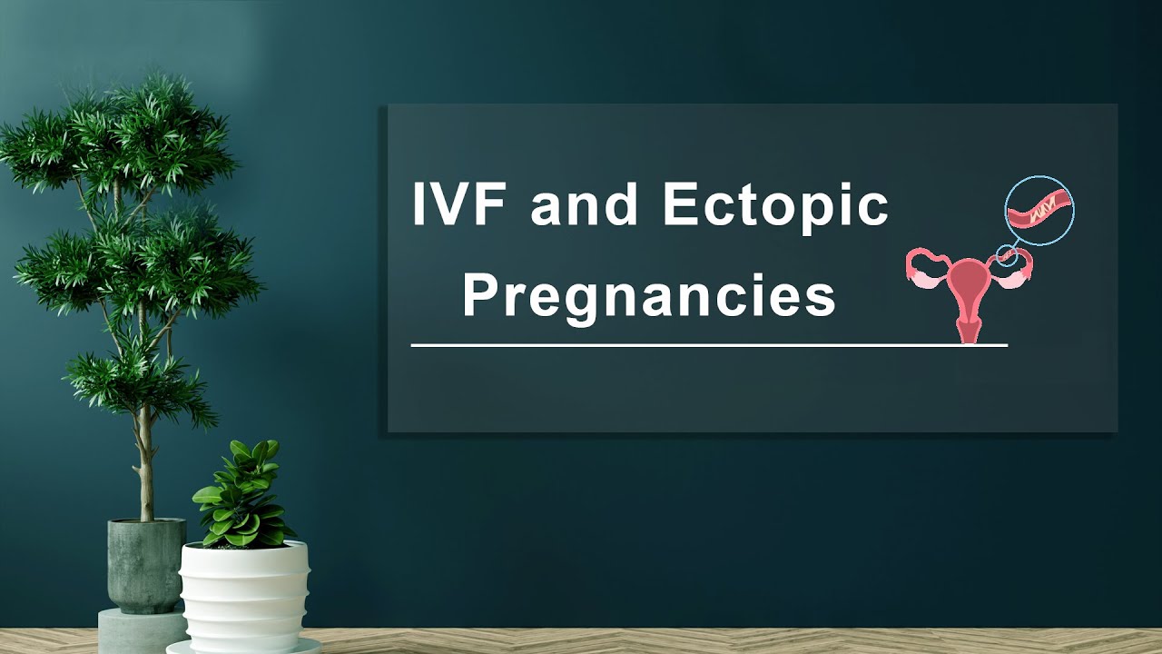 FAQ IN IVF || IVF and Ectopic Pregnancies || - YouTube