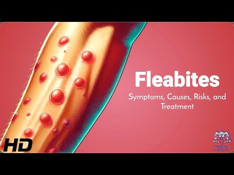 How Do Rashes From Fleas Bites Look