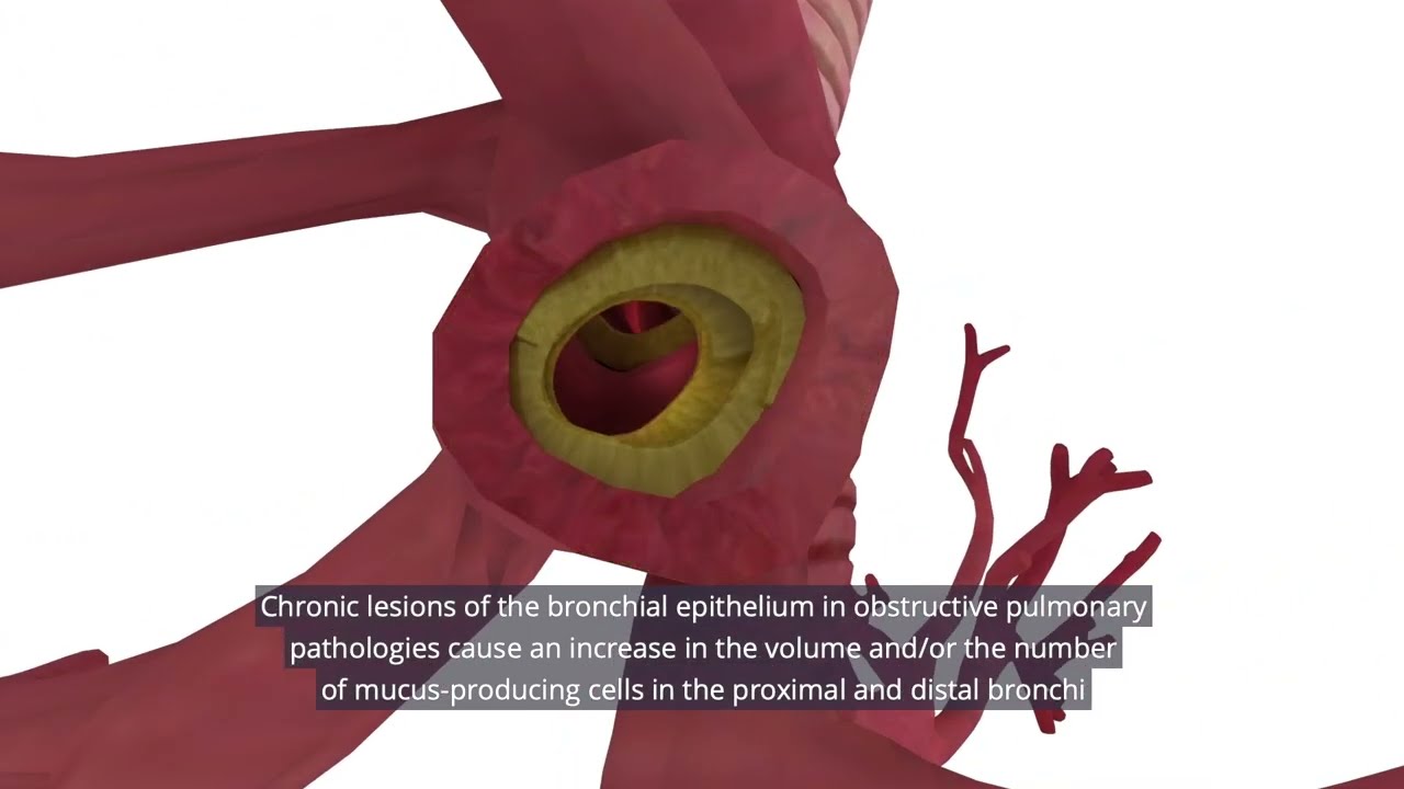 All about bronchial mucus - PhysioAssist - YouTube