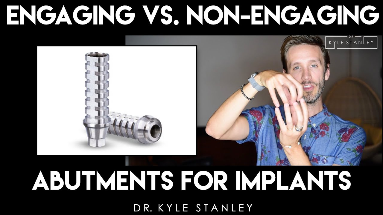 Engaging vs Non-engaging abutments for dental implants - YouTube