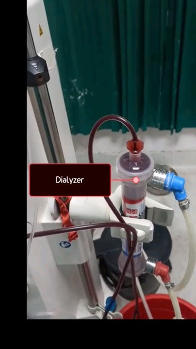 Indications of Dialysis | Dialyzer | Diffusion in Dialysis Dialyzer | Principle of dialysis ...