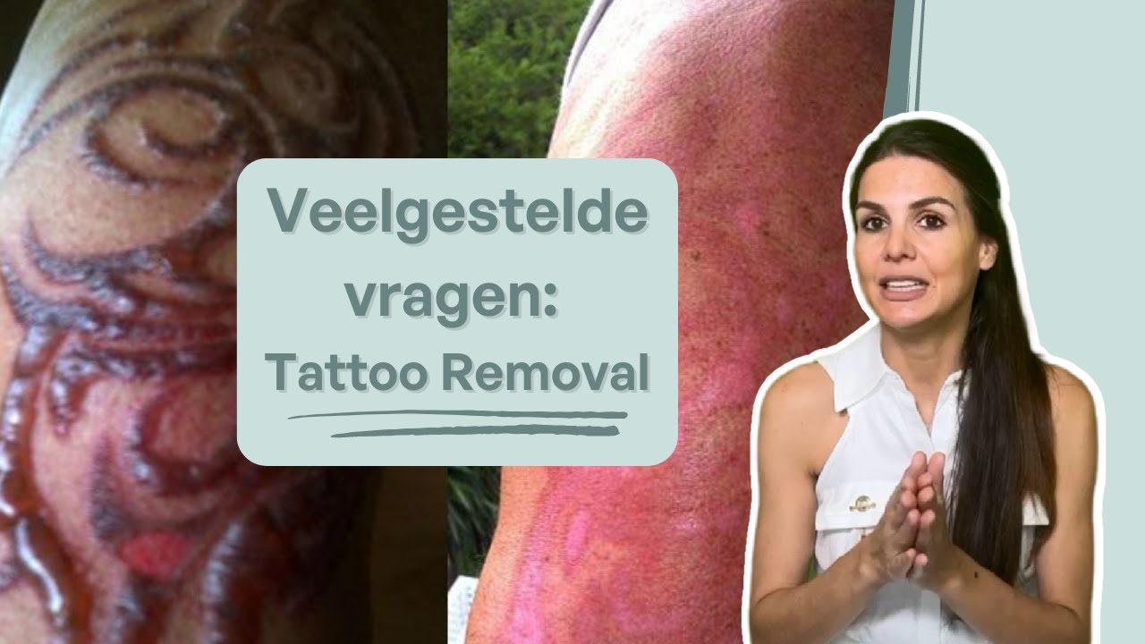 Wanneer Korstjes Tattoos Voor En Nazorg Tattoo Verwijderen