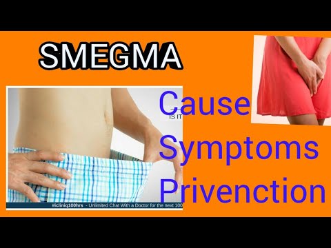 SMEGMA-Cause , Prevenction and Treatment - YouTube