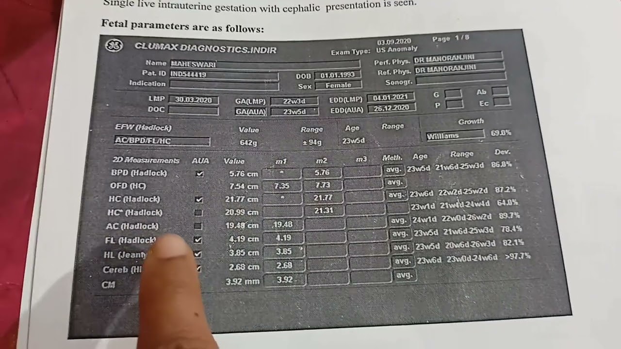 Boy Baby Anomaly Tiffa Scan Report CRL FHR Doppler Scan Report Boy Baby Anomaly Tiffa Scan Report CRL FHR Doppler Scan Report