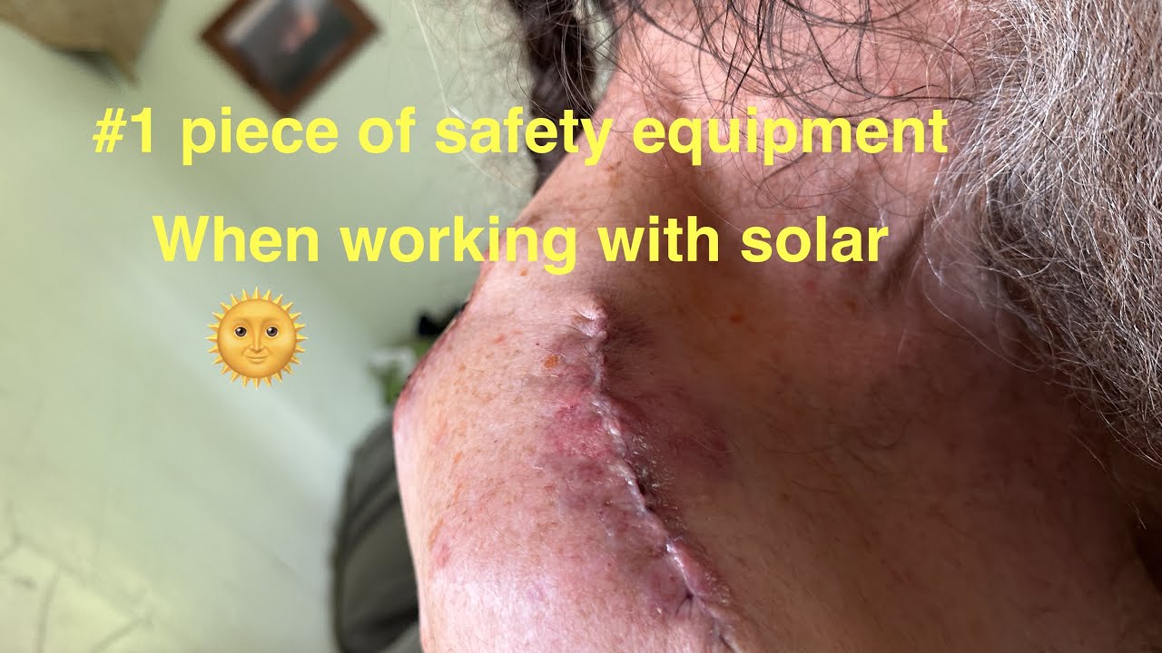 #1 safety concern working with solar. Too much sun can be hazardous to ...