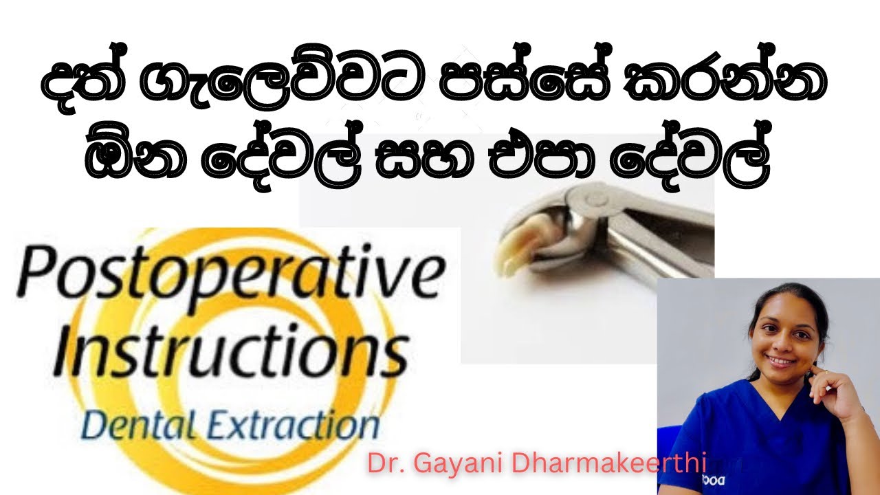 දතක් ගැලෙව්වට පසුව කල යුතු දේ සහ නොකල යුතු දේ | Post extraction ...