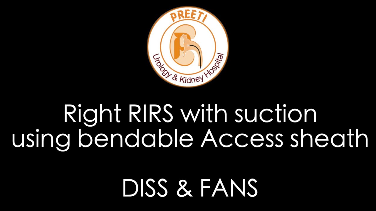 Right RIRS with suction using bendable Access sheath - DISS & FANS ...