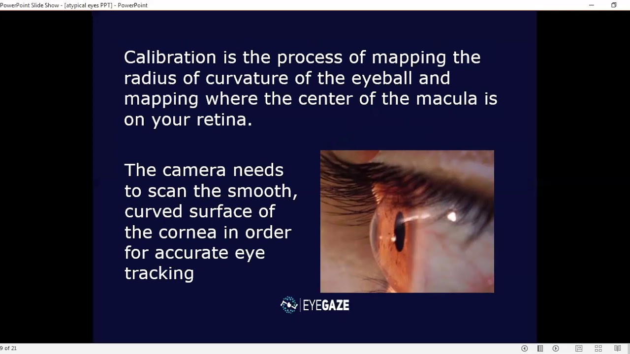 What SLPs need to know for eyegaze AAC access with less-than-perfect ...