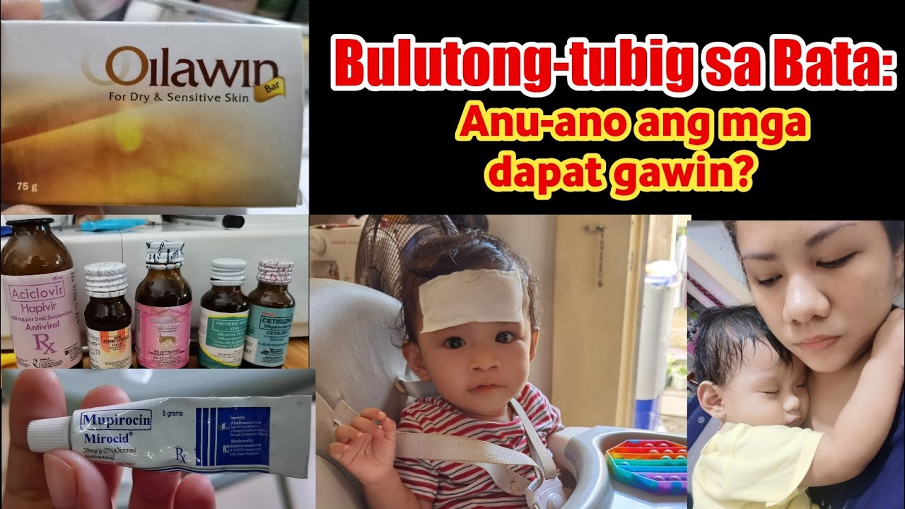 May Chickenpox si Baby CJ! | Mga Gamot sa Bulutong-tubig ni Baby - YouTube