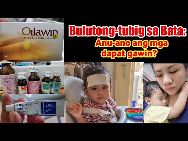 Bulutong Tubig Lunas