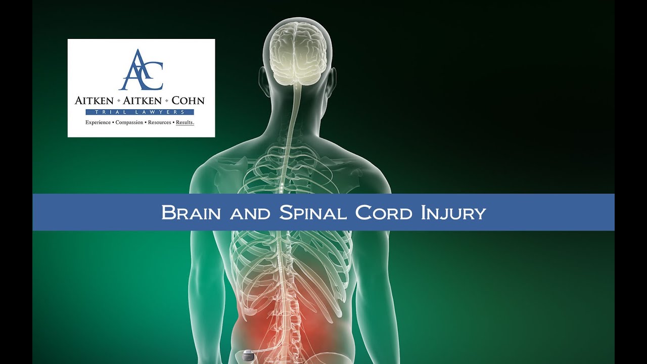 Defending Brain and Spinal Cord Injury Victims - YouTube