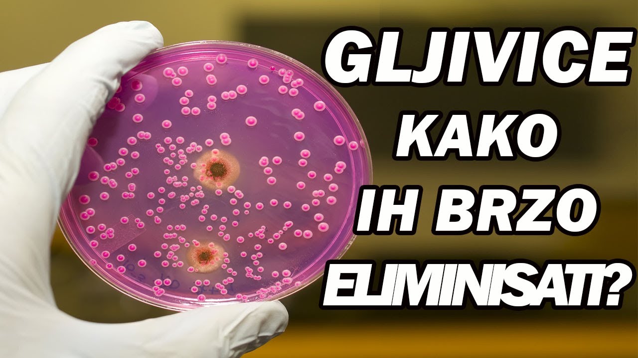 PRIRODNO LIJEČENJE KANDIDE! Dr Mihajlović - YouTube