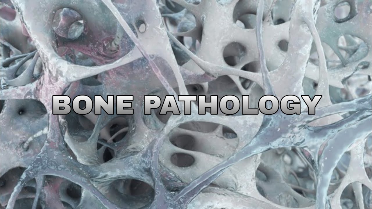Bone pathology 1st lecture. - YouTube