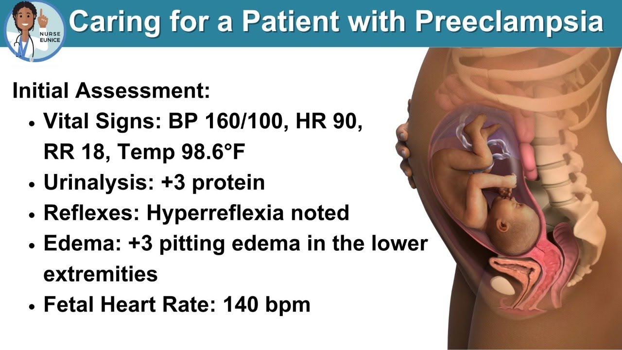 CNA & PCT Practice Test - Caring for a Patient with Preeclampsia🤰 - YouTube