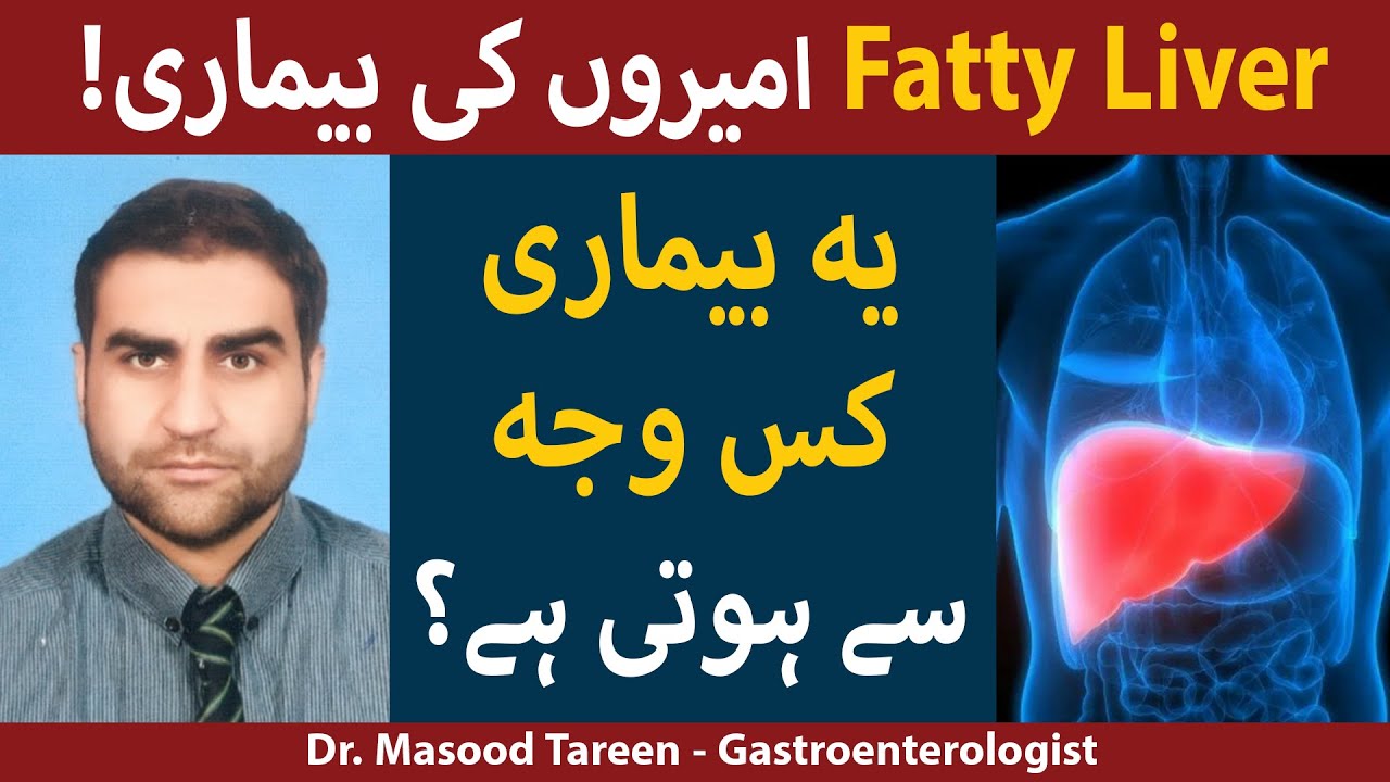 Fatty Liver Symptoms, Causes, And Treatment | Fatty Liver Kya Hota Hai | Fatty Liver Ka Ilaj ...