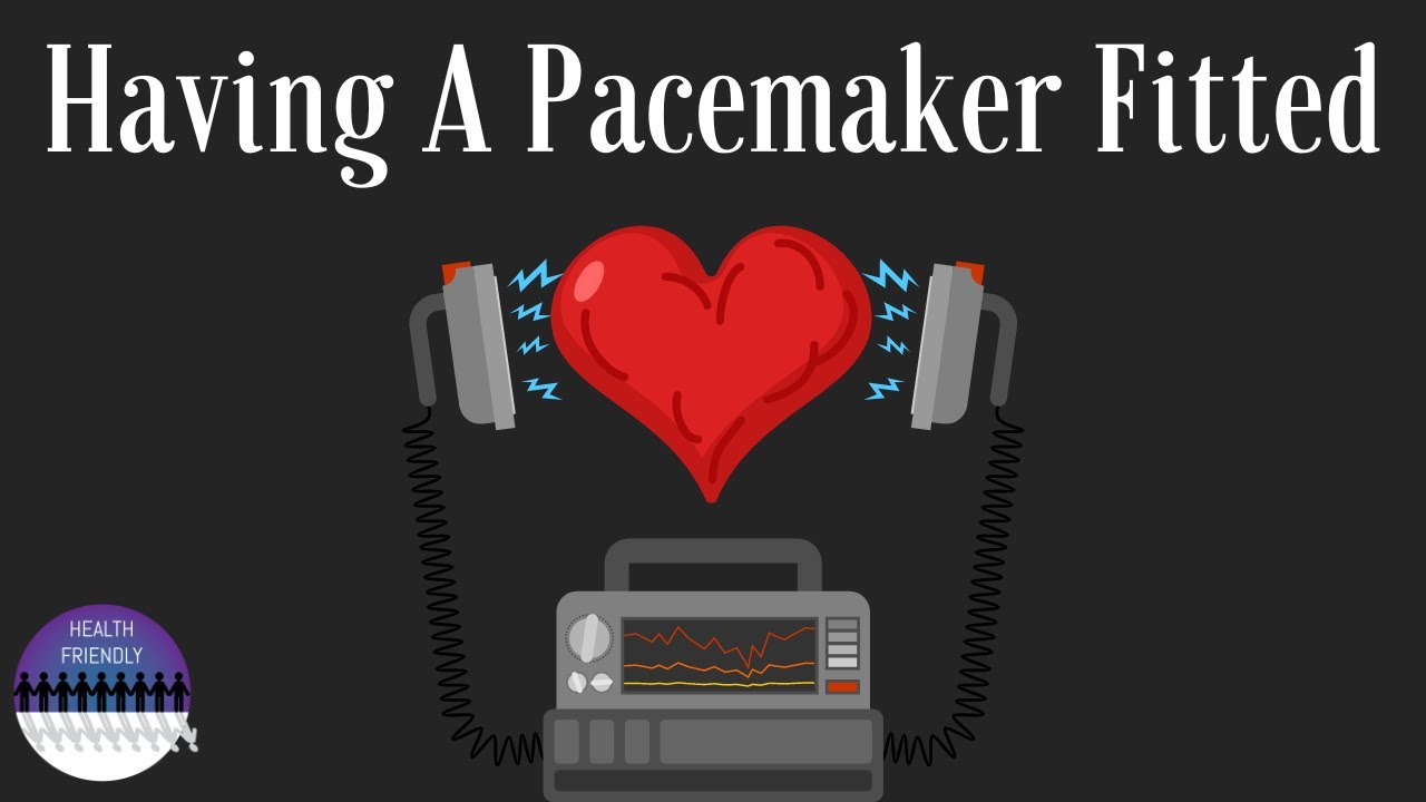 Having A Pacemaker Fitted Youtube