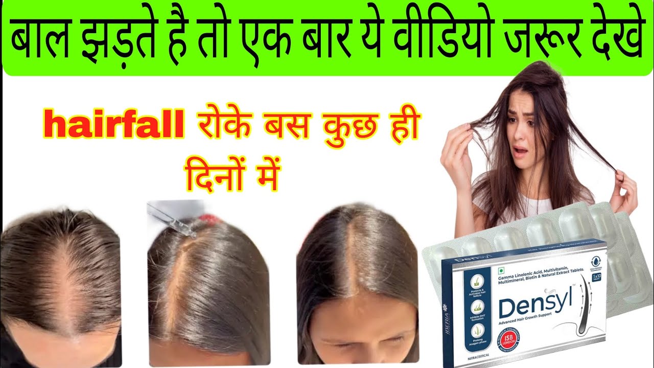 Densyl Tablet Review Best Tablet For Alopesia & Hairfall In Hindi - YouTube
