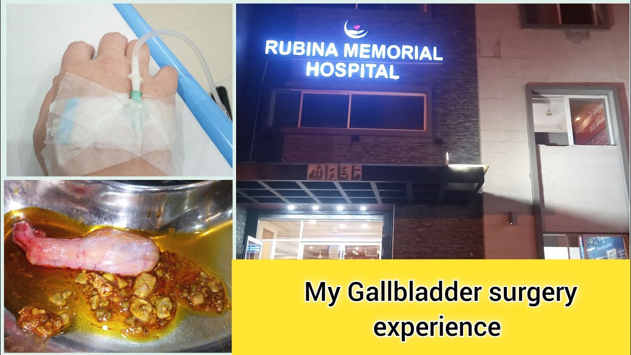 My Gallbladder removel surgery experience|| laparoscopic ( Goodbye Gall ...