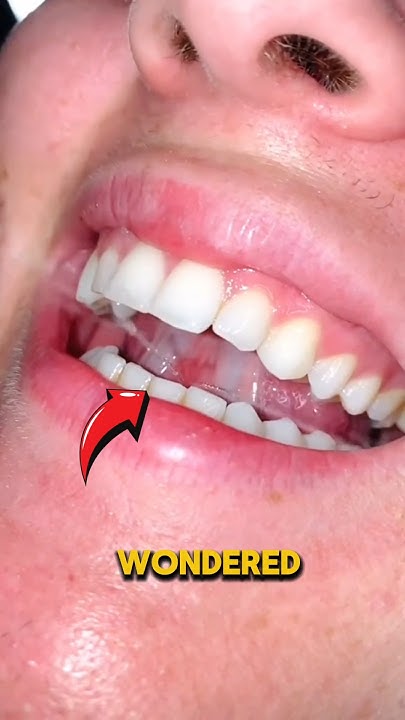 How To Gleek 🤔 - YouTube