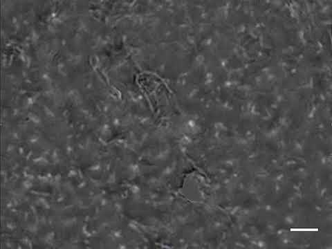 4. E. coli swarm in microchannel