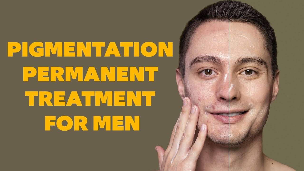 Pigmentation Permanent Treatment for Men | Best Dermatologist in Hyd ...