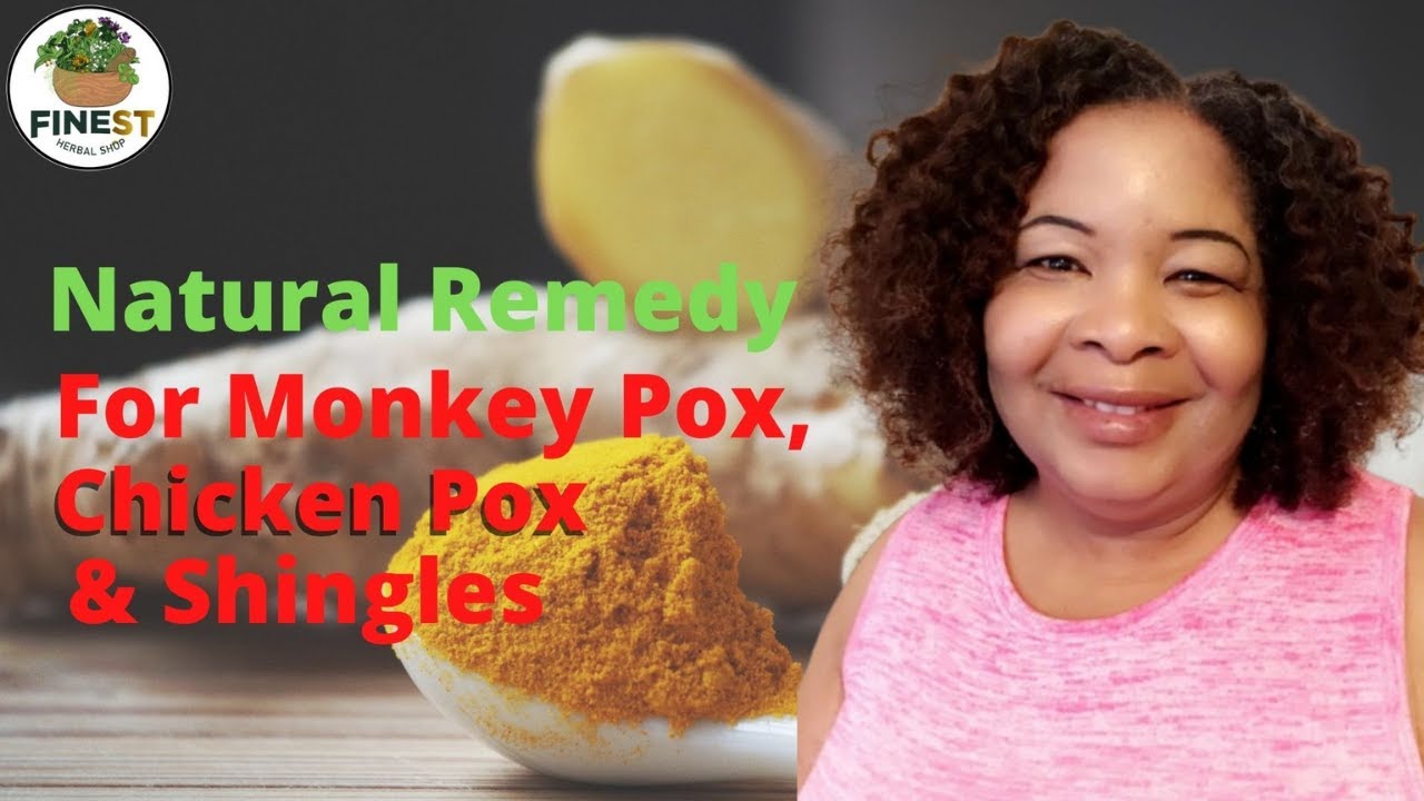 Natural Remedy For Monkeypox, Chickenpox, And Shingles - YouTube