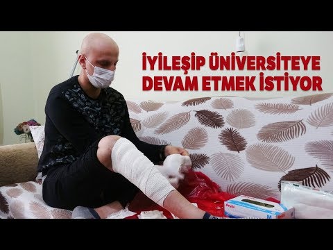 210 Bin Lira Bulamazsa Bacağı Kesilecek