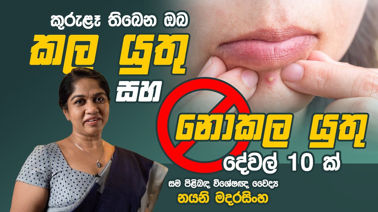 කුරුලෑ සඳහා කල යුතු දේ සහ නොකල යුතු දේ | How to get rid of acne? | Dr ...