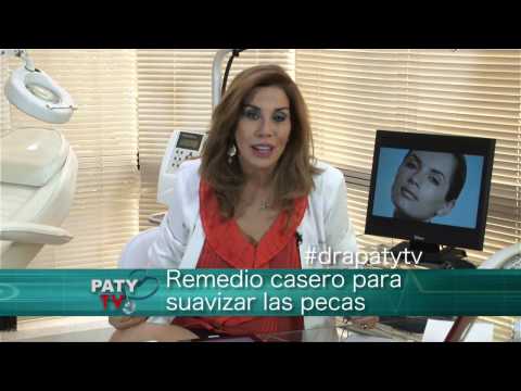 Remedio casero pecas - Dra. Paty Tv