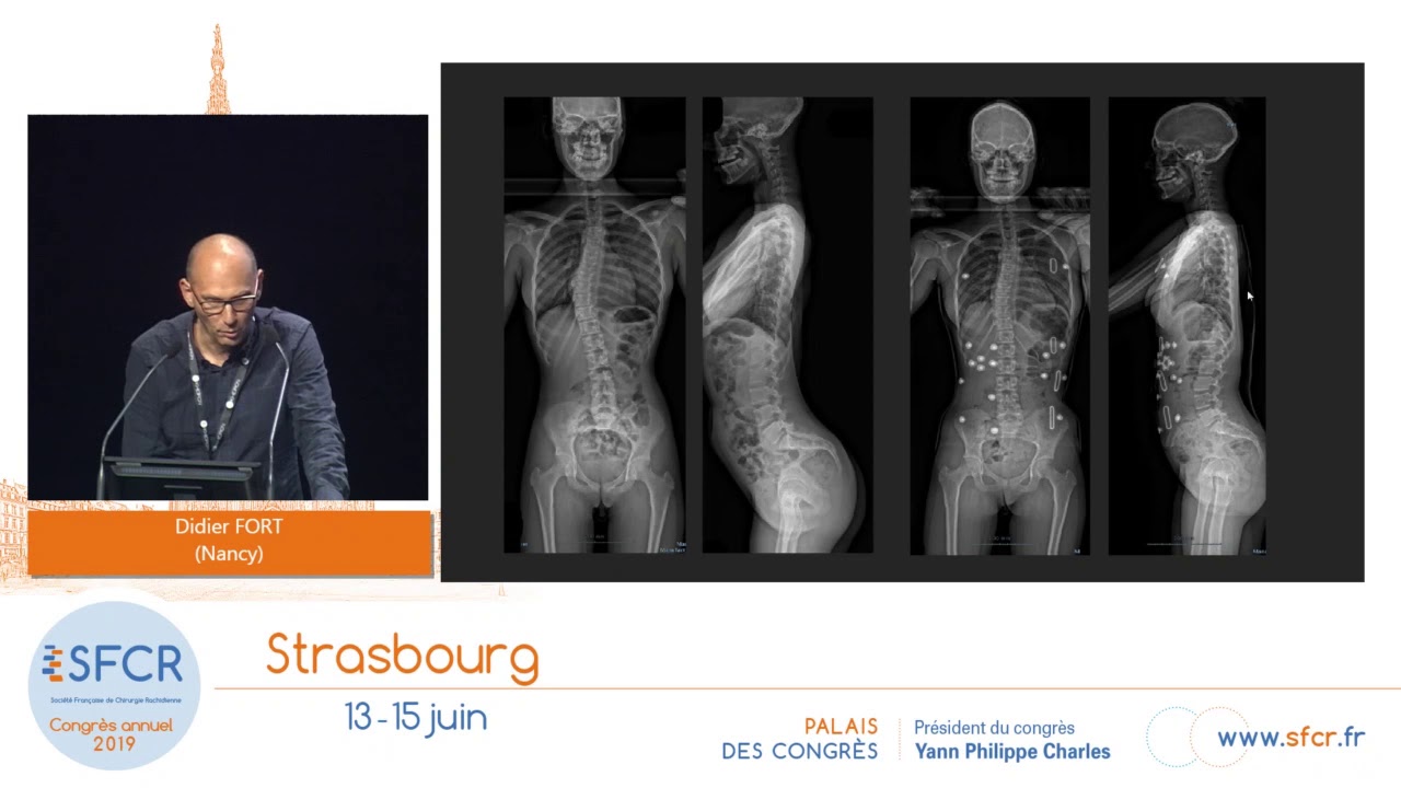 Le plan sagittal et le plan horizontal. D. Fort (Nancy) - YouTube