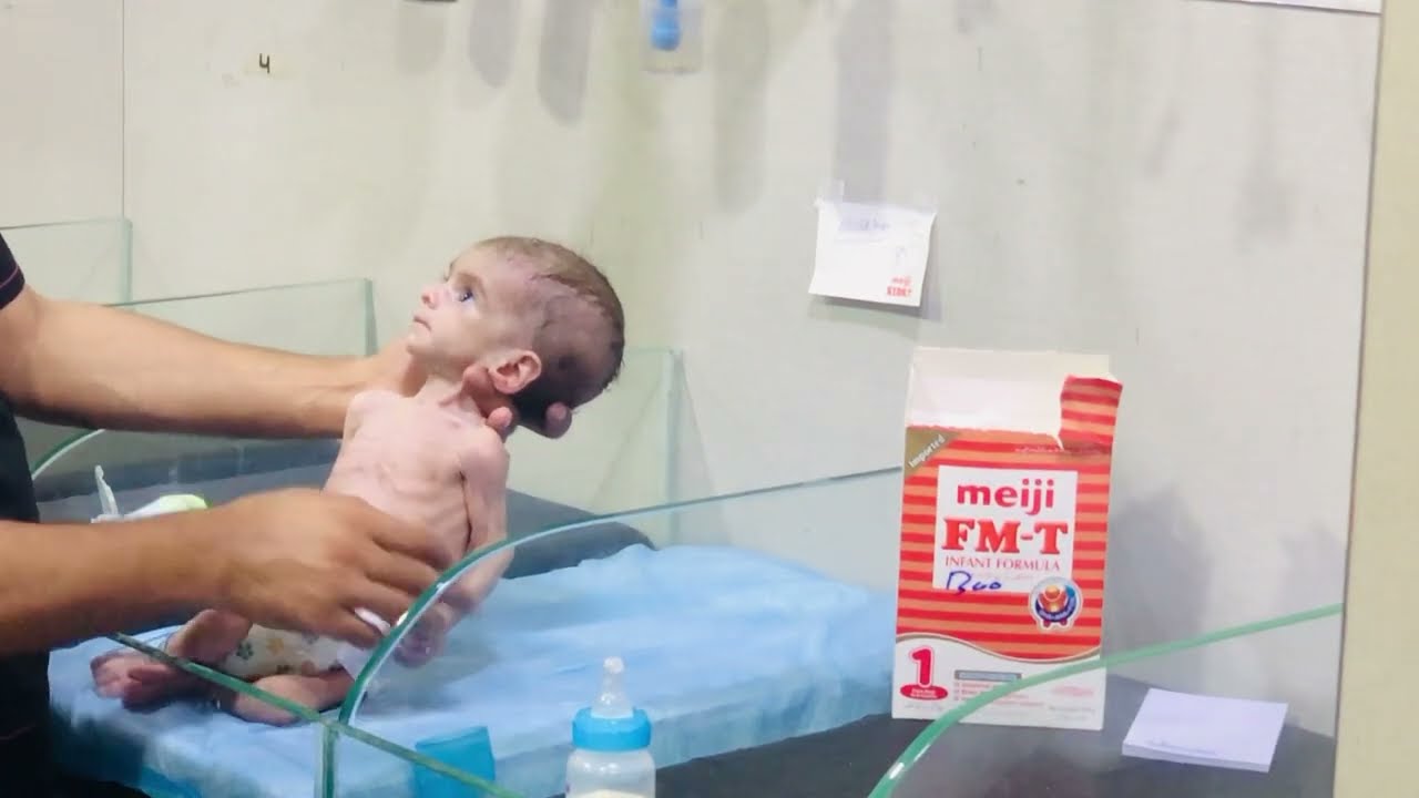 Abubakar baby #feedingintolerance #newbornbaby #niculife #cutebaby # ...